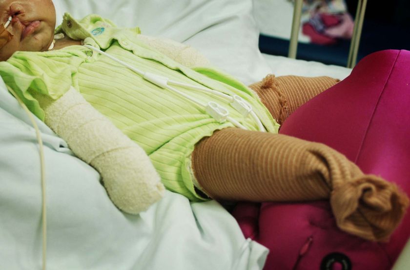 Calls to vaccinate against meningococcal disease ahead of winter peak ...