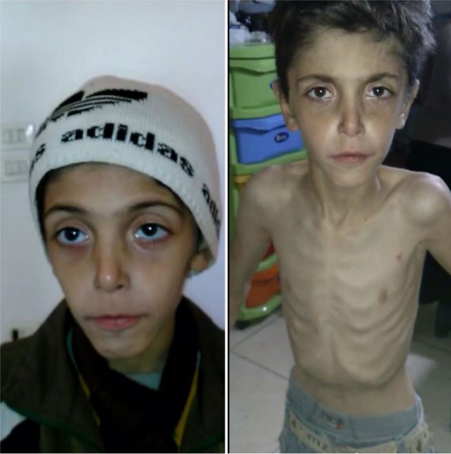 Madaya: Face of starving city among 400 needing urgent medical ...
