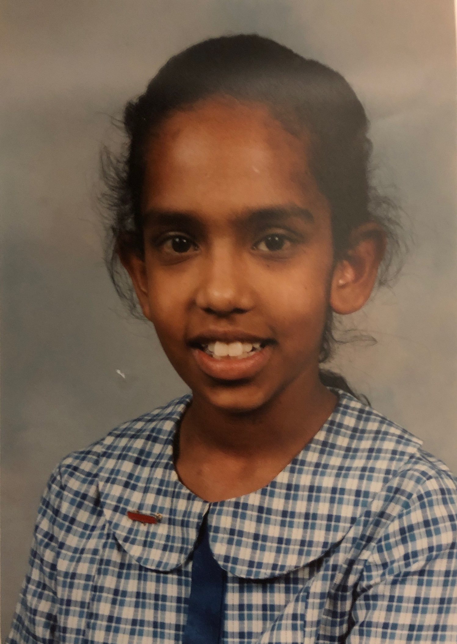 Janu was teased at school because of her tumours — three decades later ...