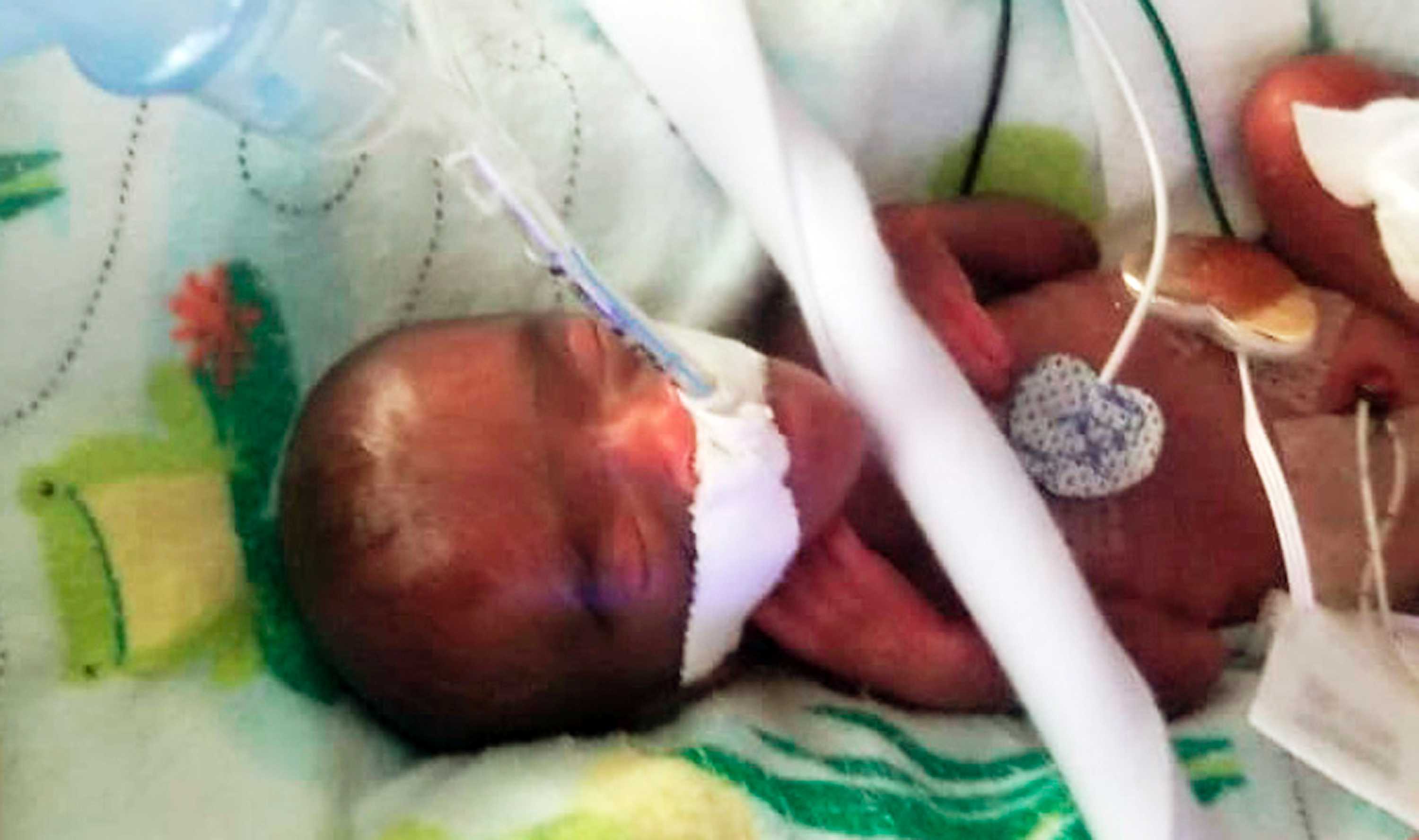 Baby Saybie, born in San Diego hospital, believed to be world's tiniest ...