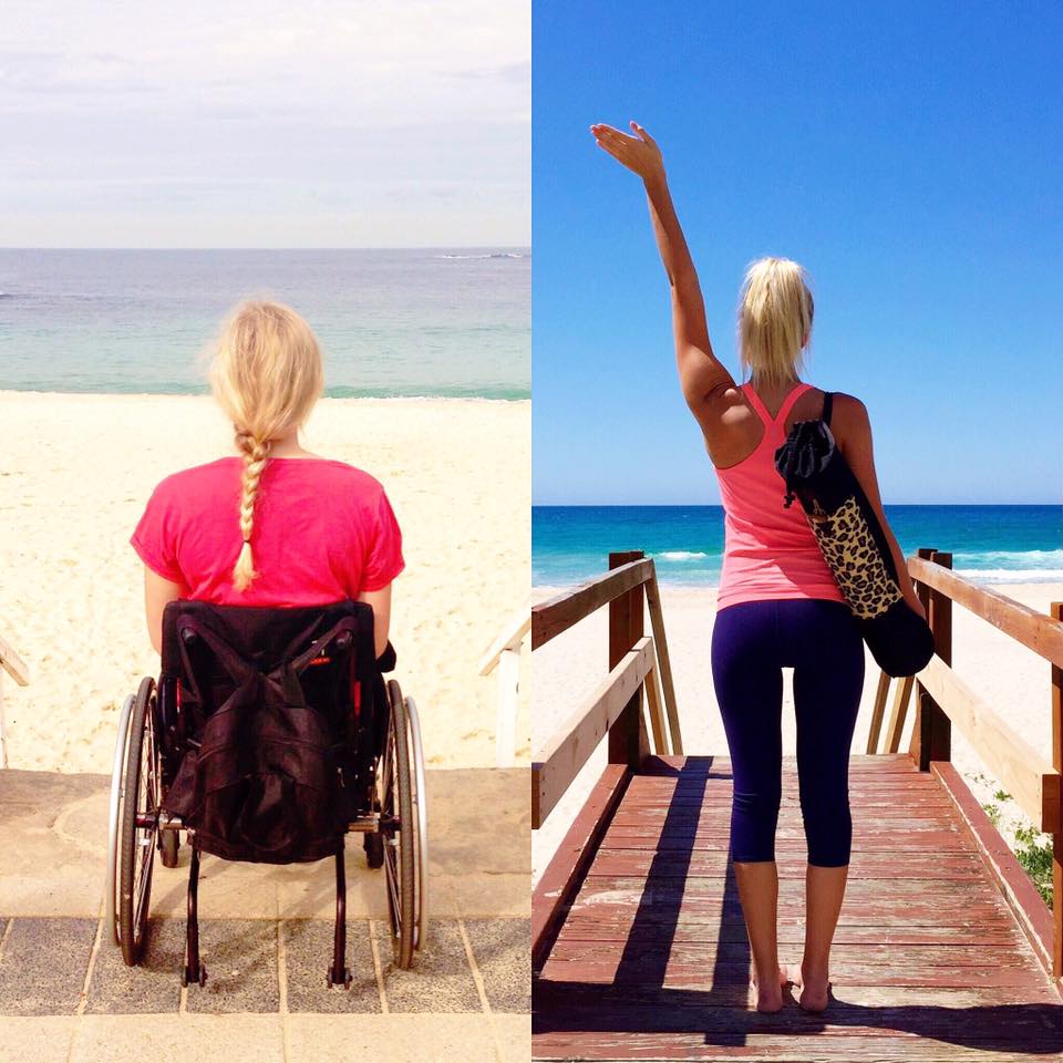 Emma Carey taught herself to walk again — now she is sharing her new ...