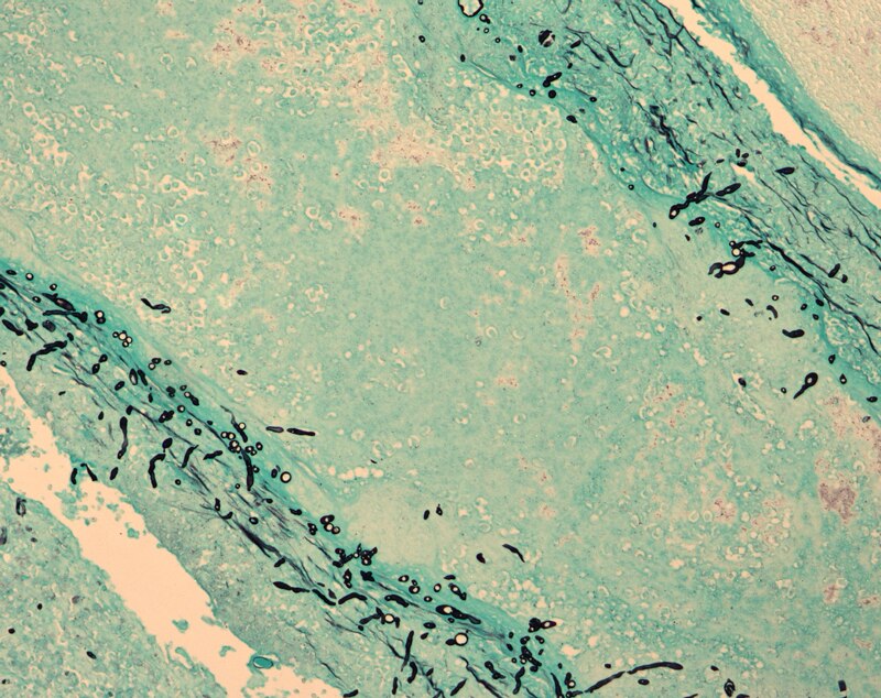 'Ticking time bomb' - ABC News