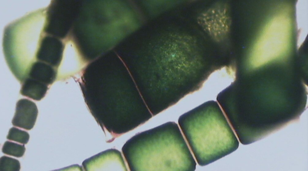 Seaweed extracts used to help reproduce human bone, repair tissue - ABC ...