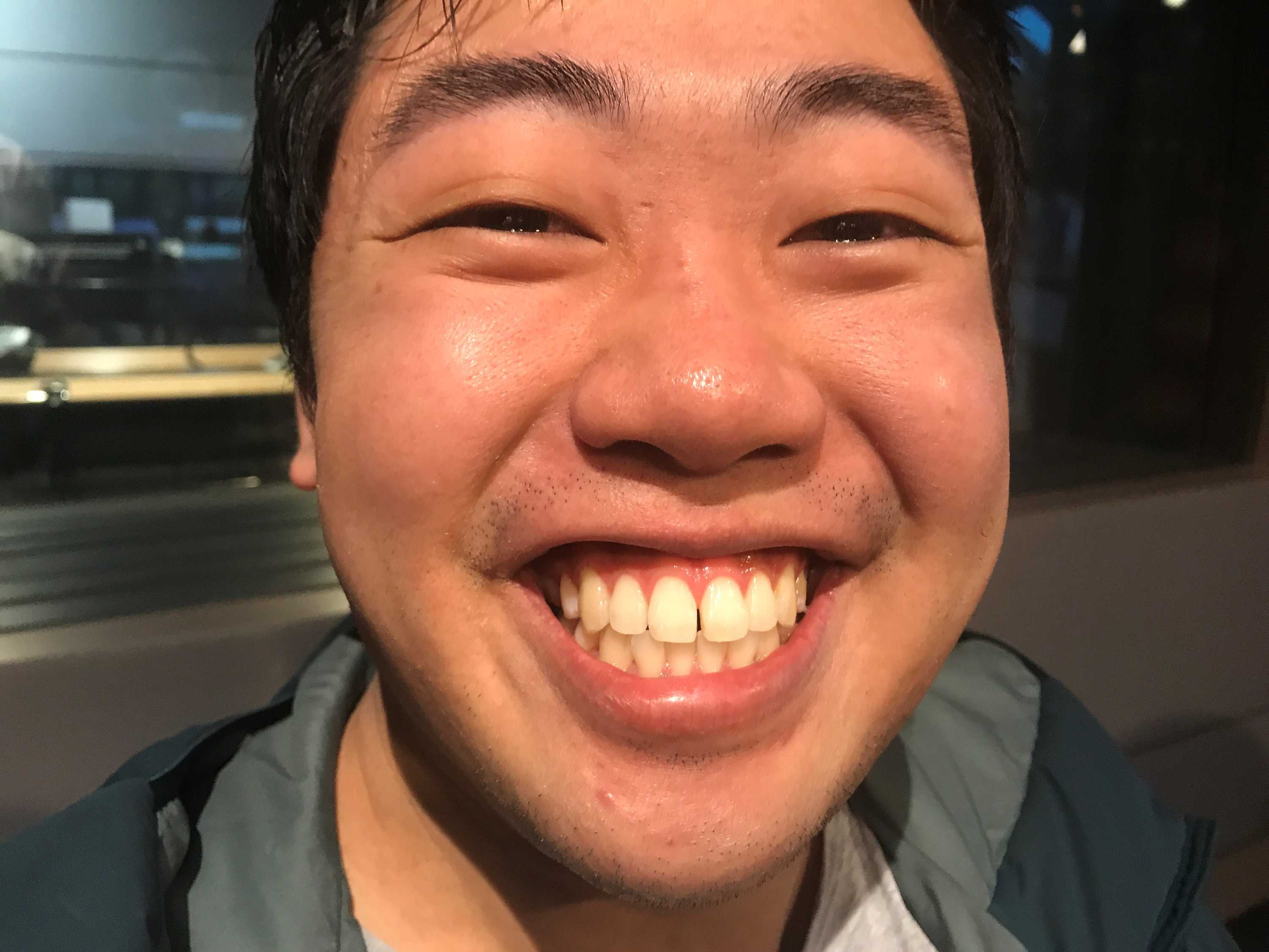 Should you brush your teeth before or after breakfast? - ABC listen