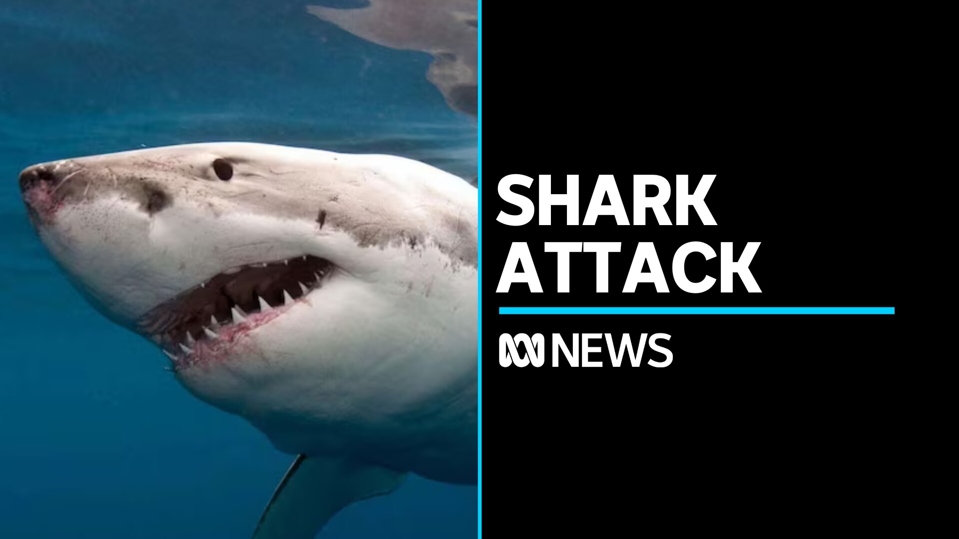 Shark attack leaves woman with serious leg injuries near Beachport ...