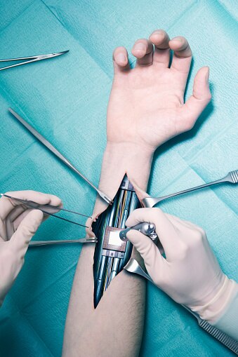 Posthuman - ABC Radio National