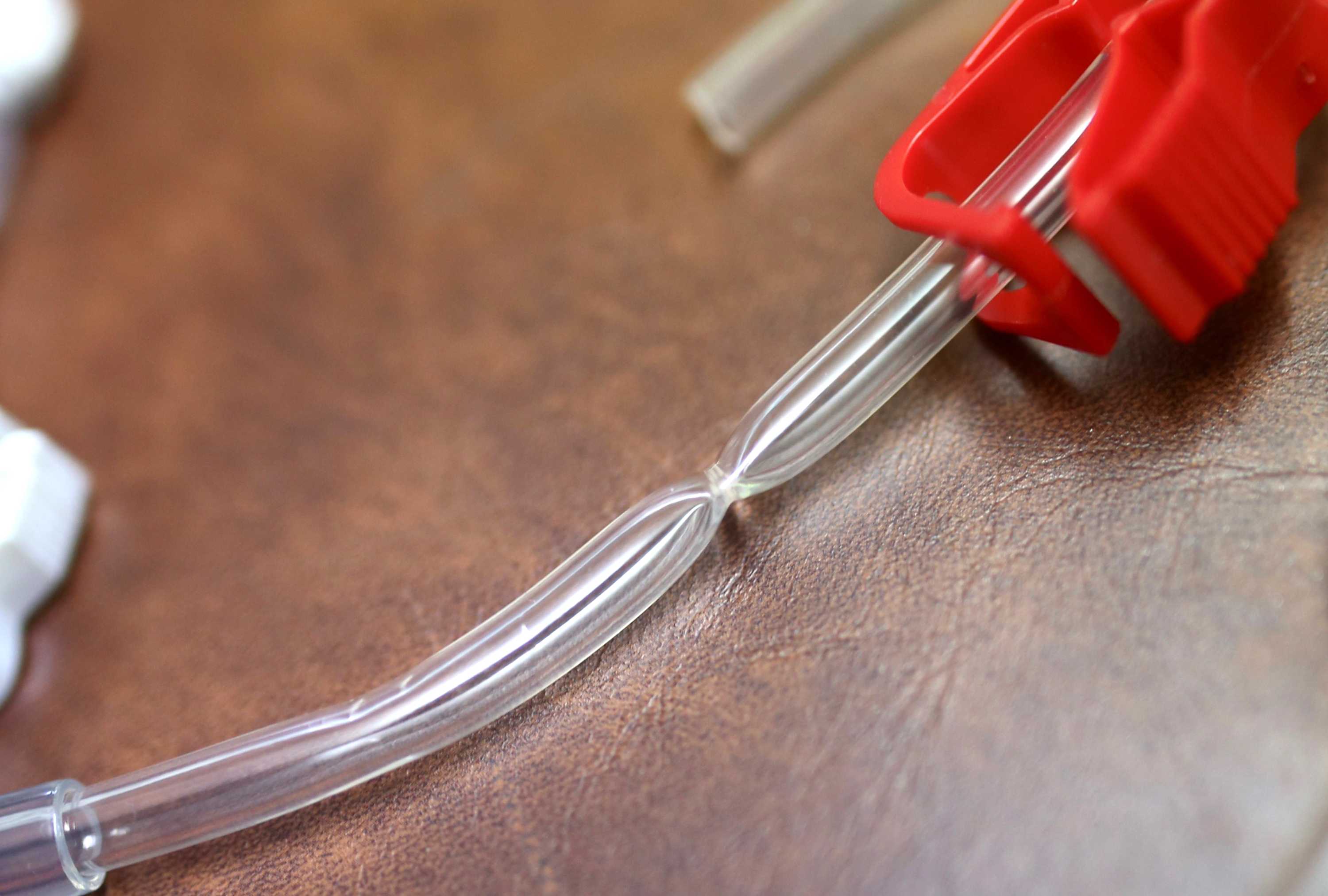 Home dialysis patient takes on German medical giant Fresenius over ...