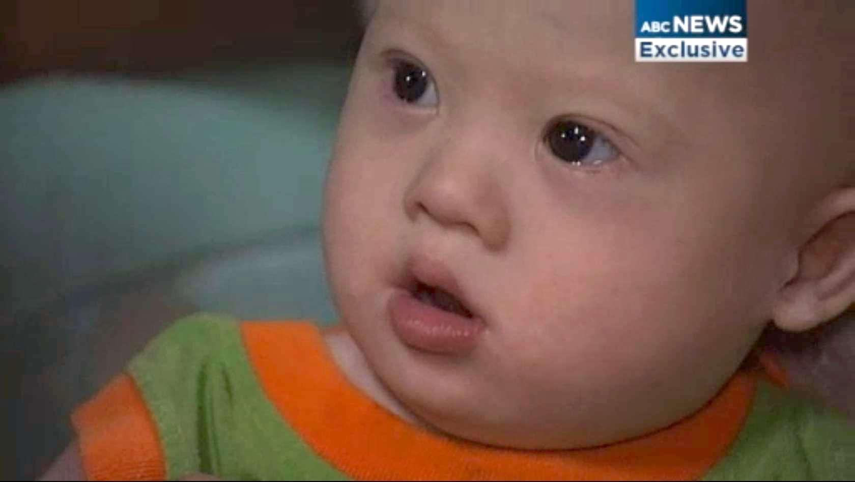 Baby Gammy: WA parents of girl born to Thai surrogate deny abandoning ...