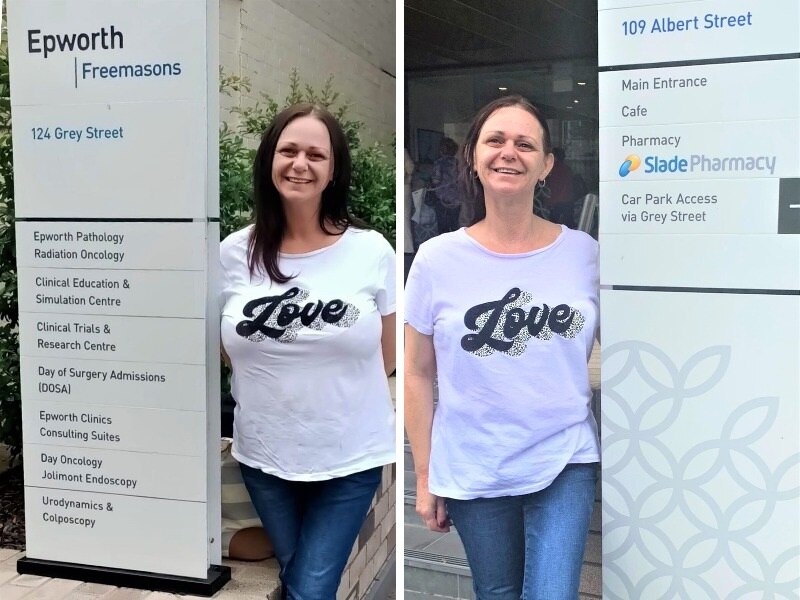 Breast reductions in Australia triple over the past three years amid ...