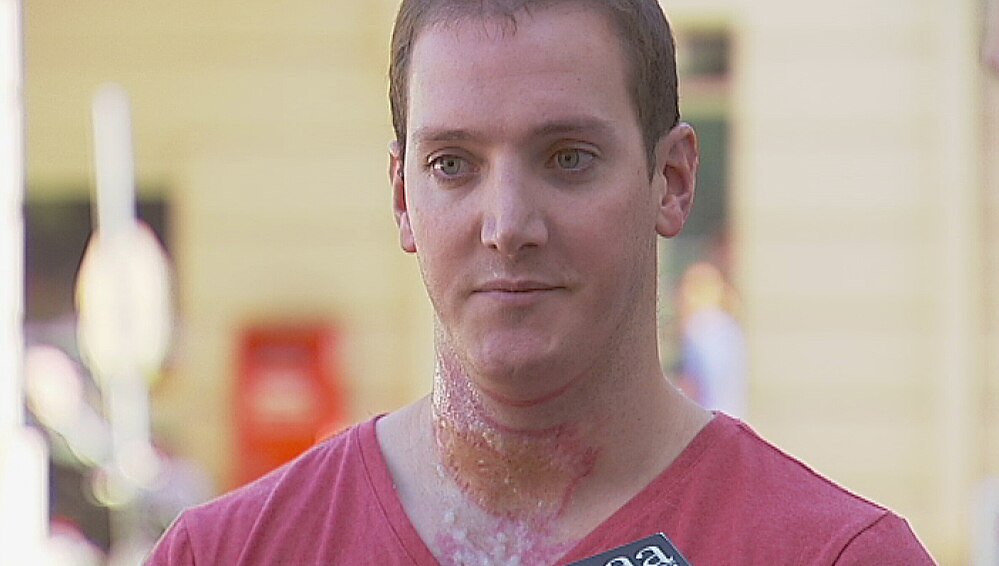 Injured firefighter out of hospital - ABC News