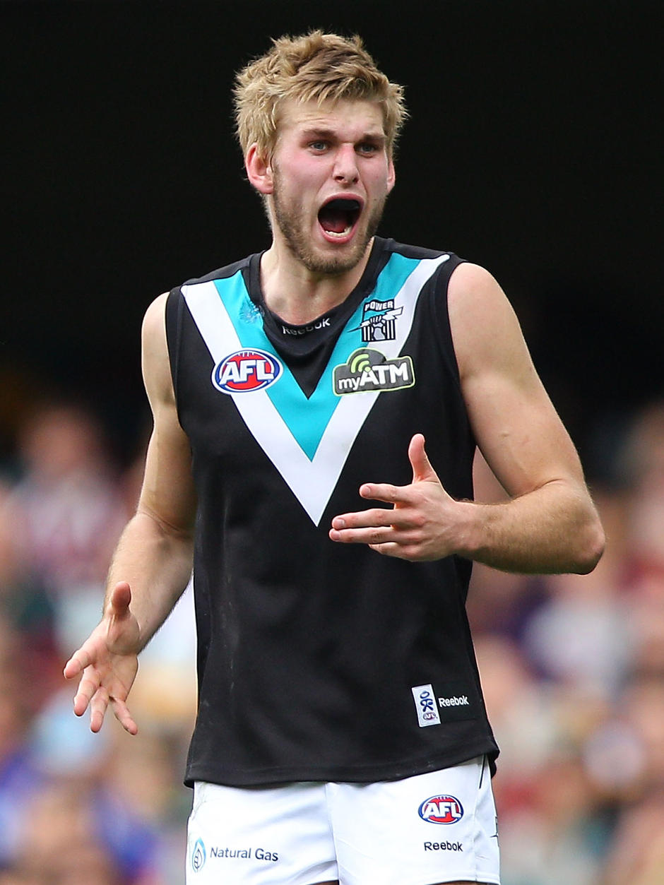 Trengove out with foot fracture - ABC News