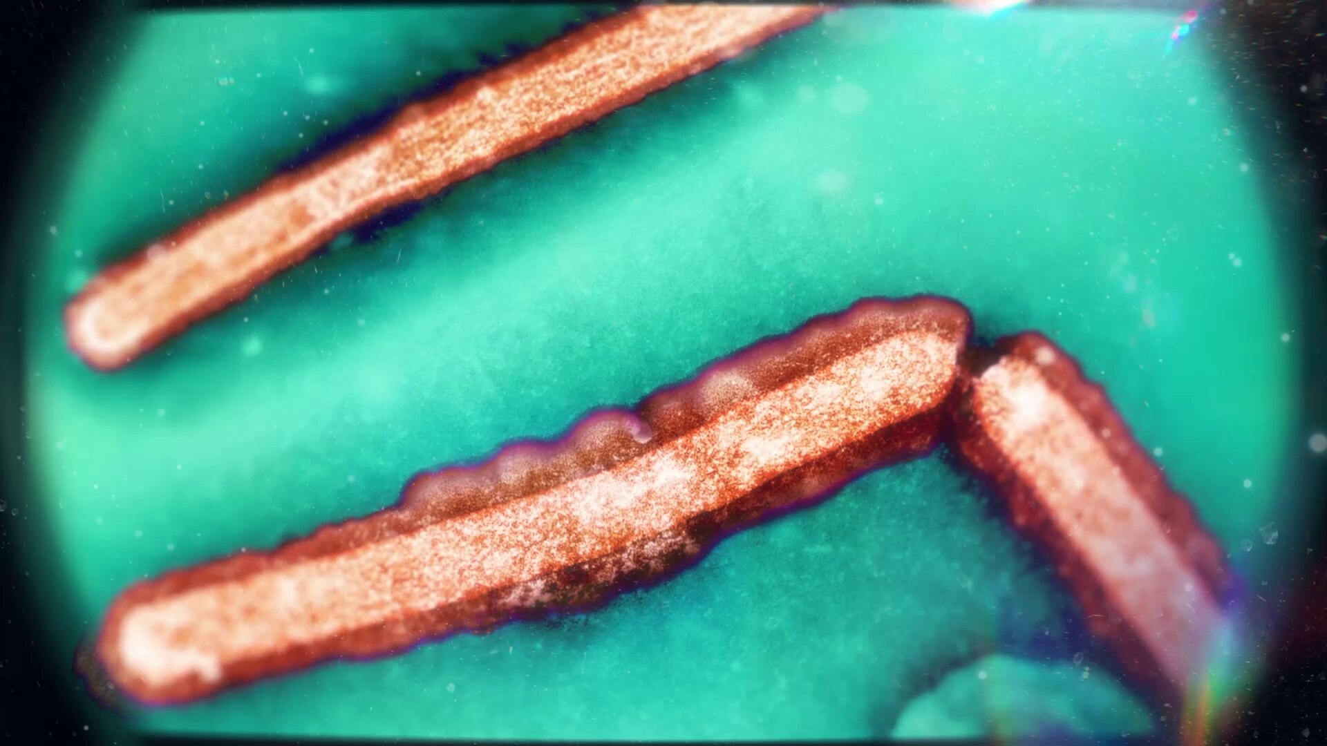 H5N1 under a microscope - ABC News