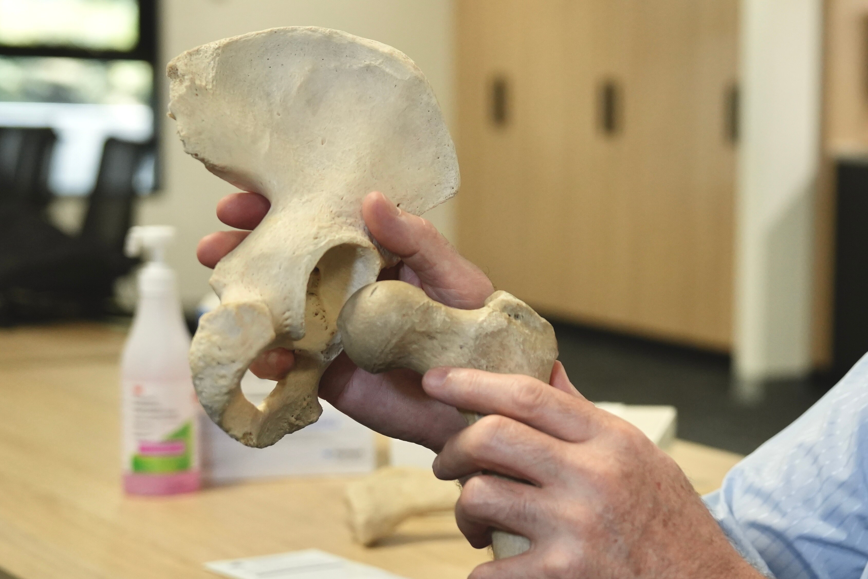 Bone banks constantly short of donors despite being the second most ...