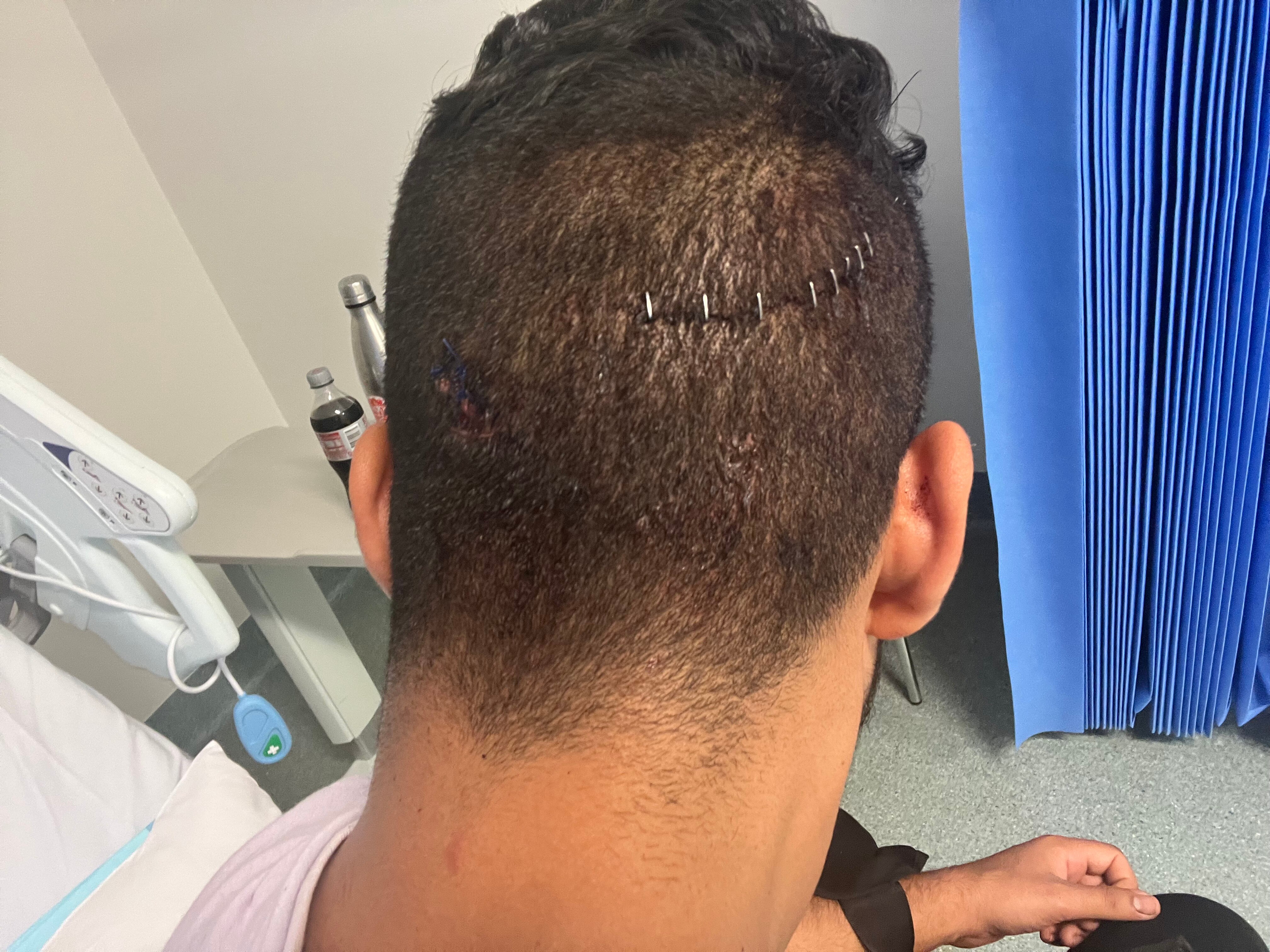 Boy allegedly involved in Bunbury taxi driver bashing released from ...