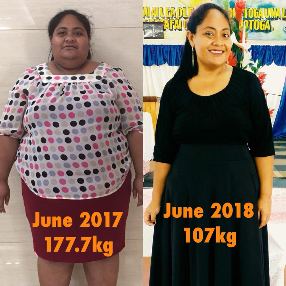 Tonga's PM challenges Pacific leaders to year-long weight loss ...