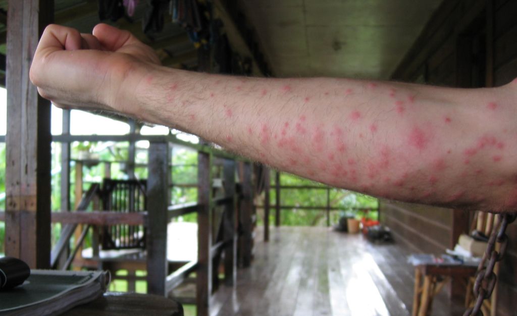 Emergency doctor's safety tips help to protect northern Australia's ...