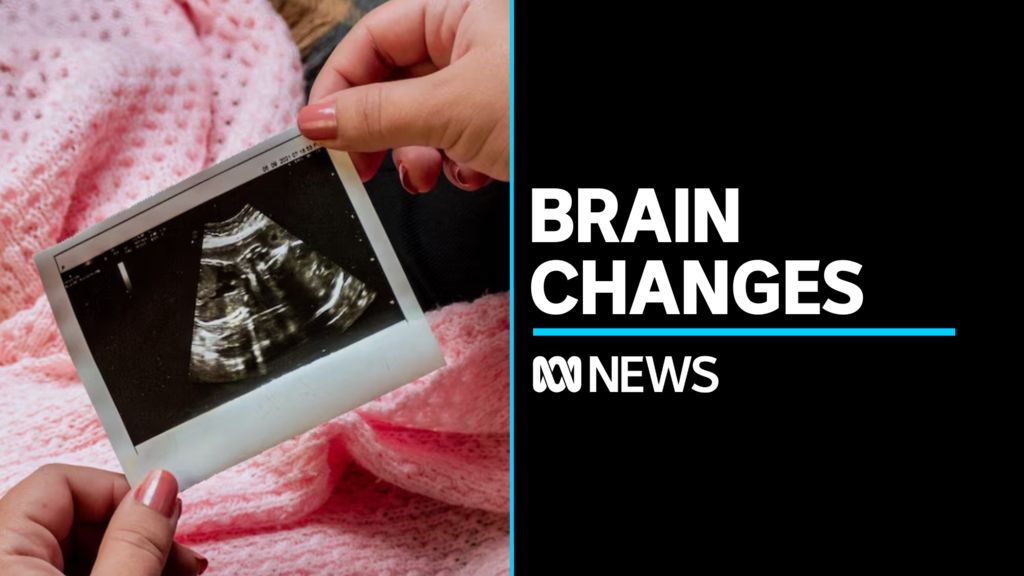 Growing evidence having a baby can change a woman’s brain - ABC News