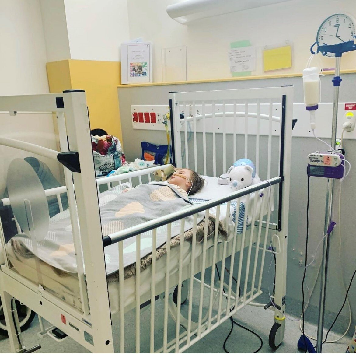Born with Lissencephaly, baby Koa defies expectations to bring smiles ...