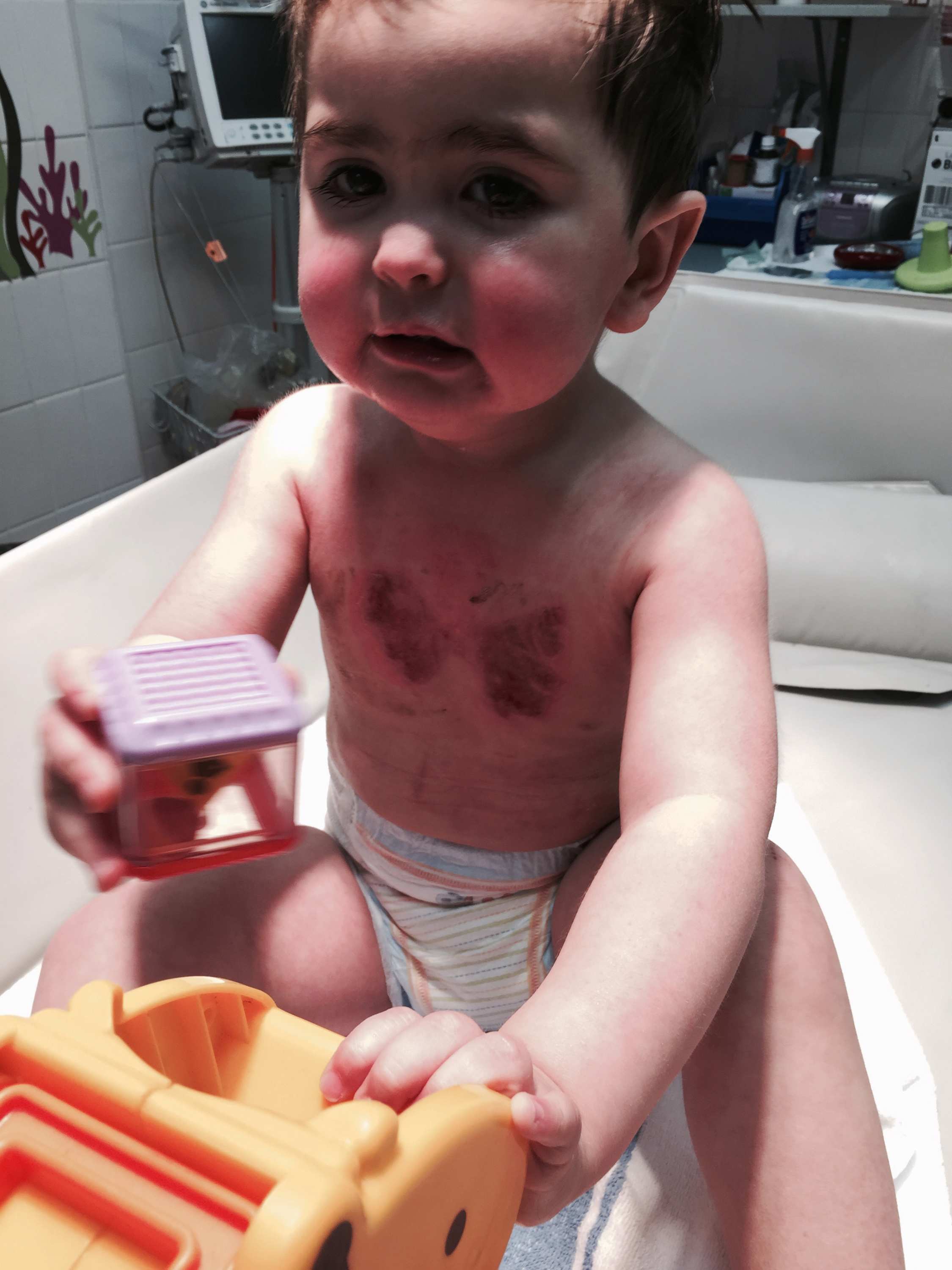 Firefighters help unveil playground for burns patients at Westmead ...