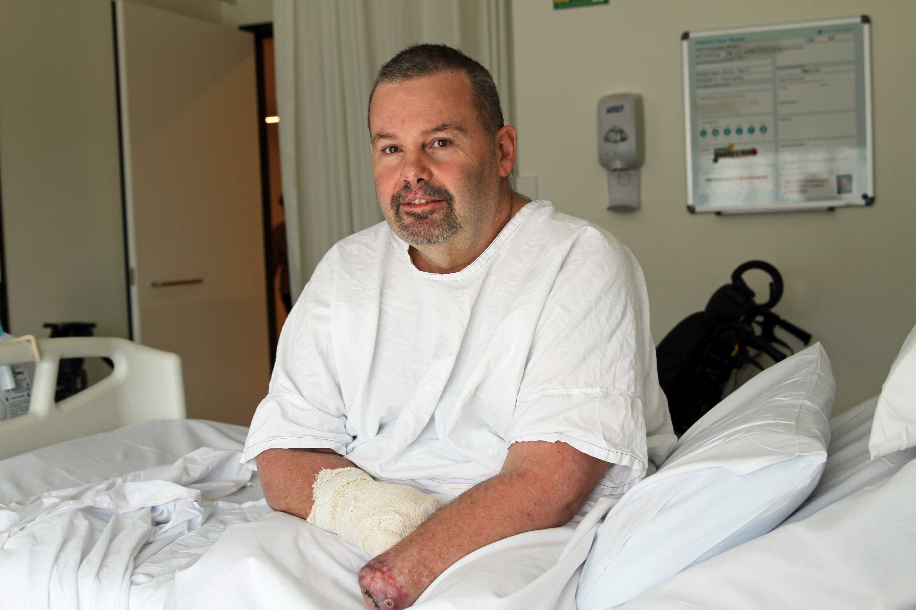 Buddy thought he just had the flu but ended up losing both hands and ...