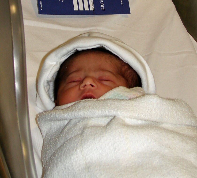 Baby defies the odds to survive ectopic birth - ABC News