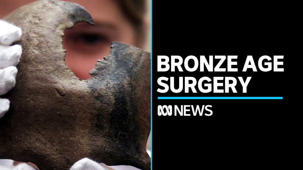 Archaeologists discover evidence of Bronze Age brain surgery - ABC News