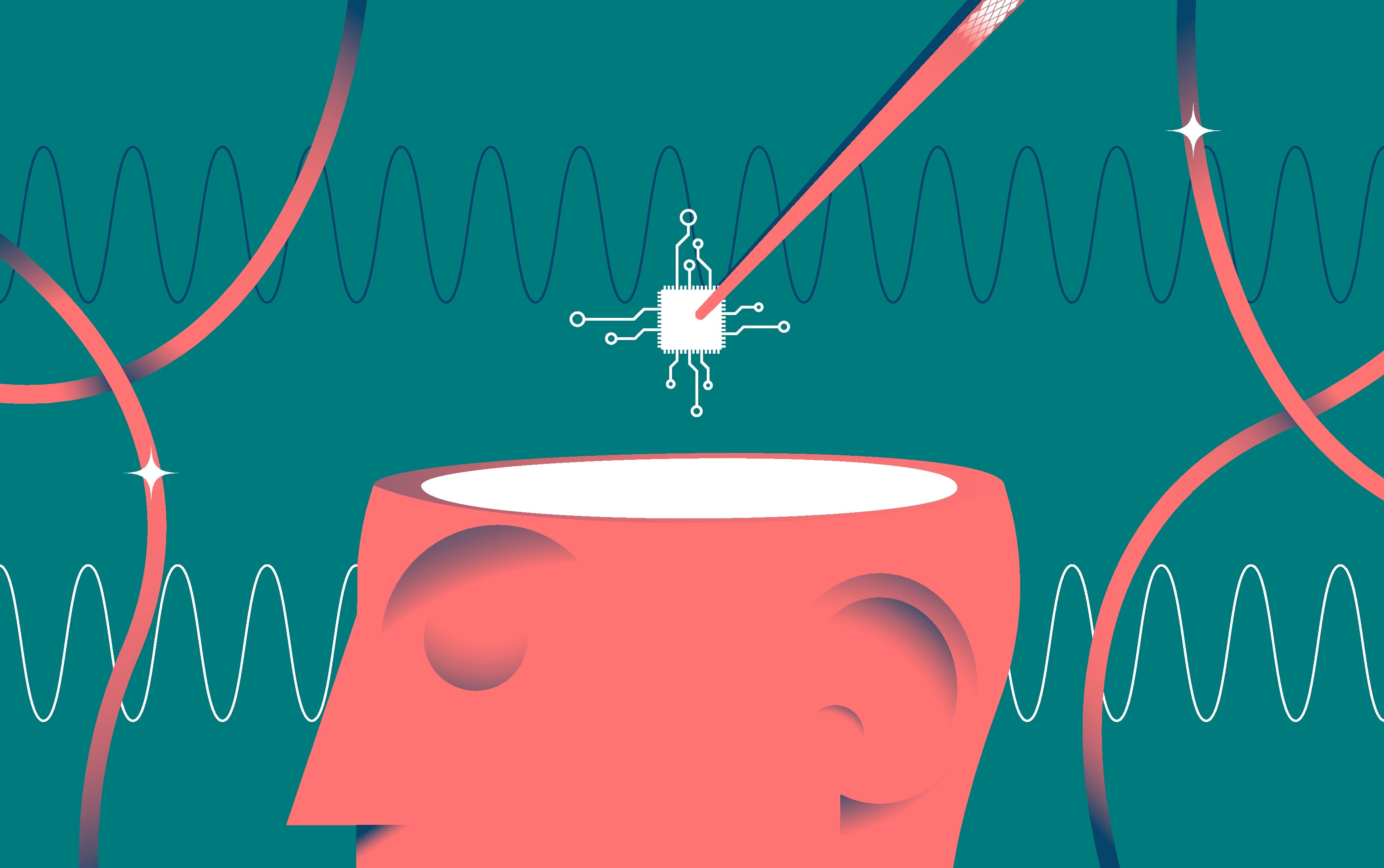 Installing computers in the brain to bring back movement - ABC listen