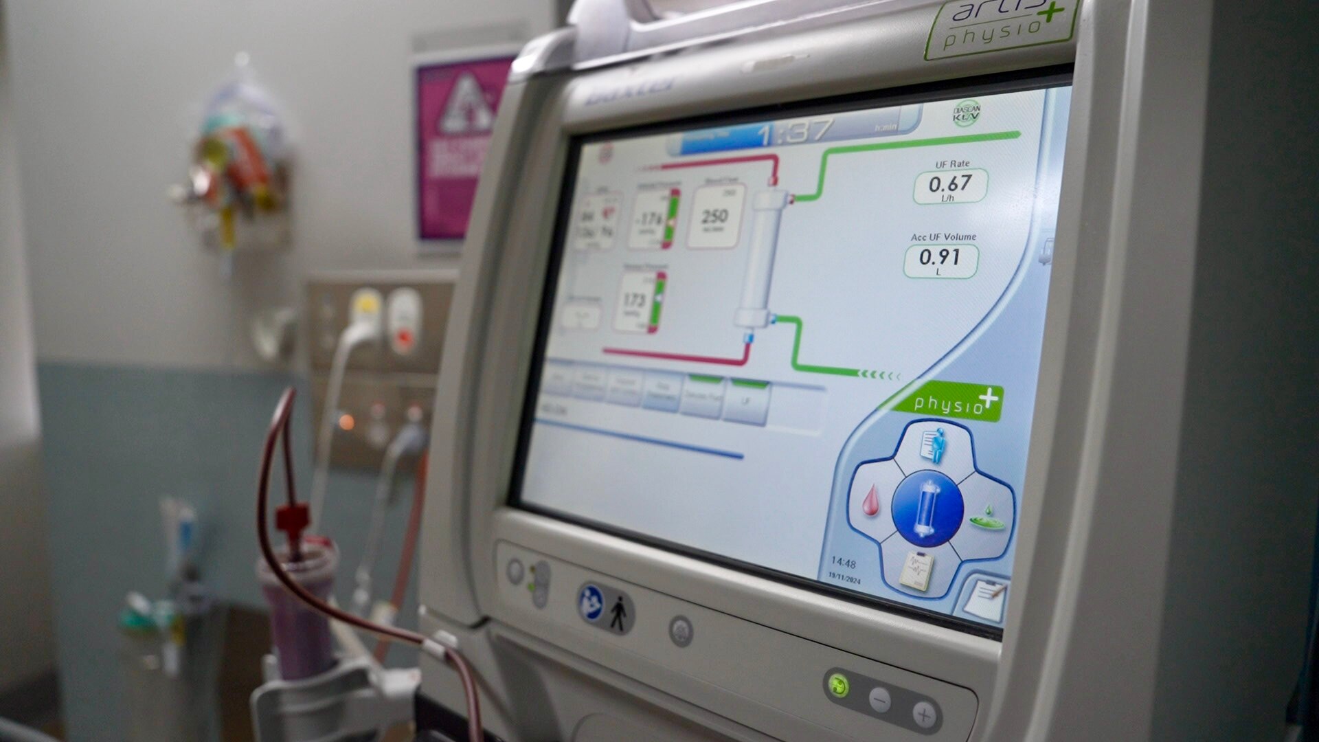 Dialysis patients report on impact treatment has on their lives amid ...