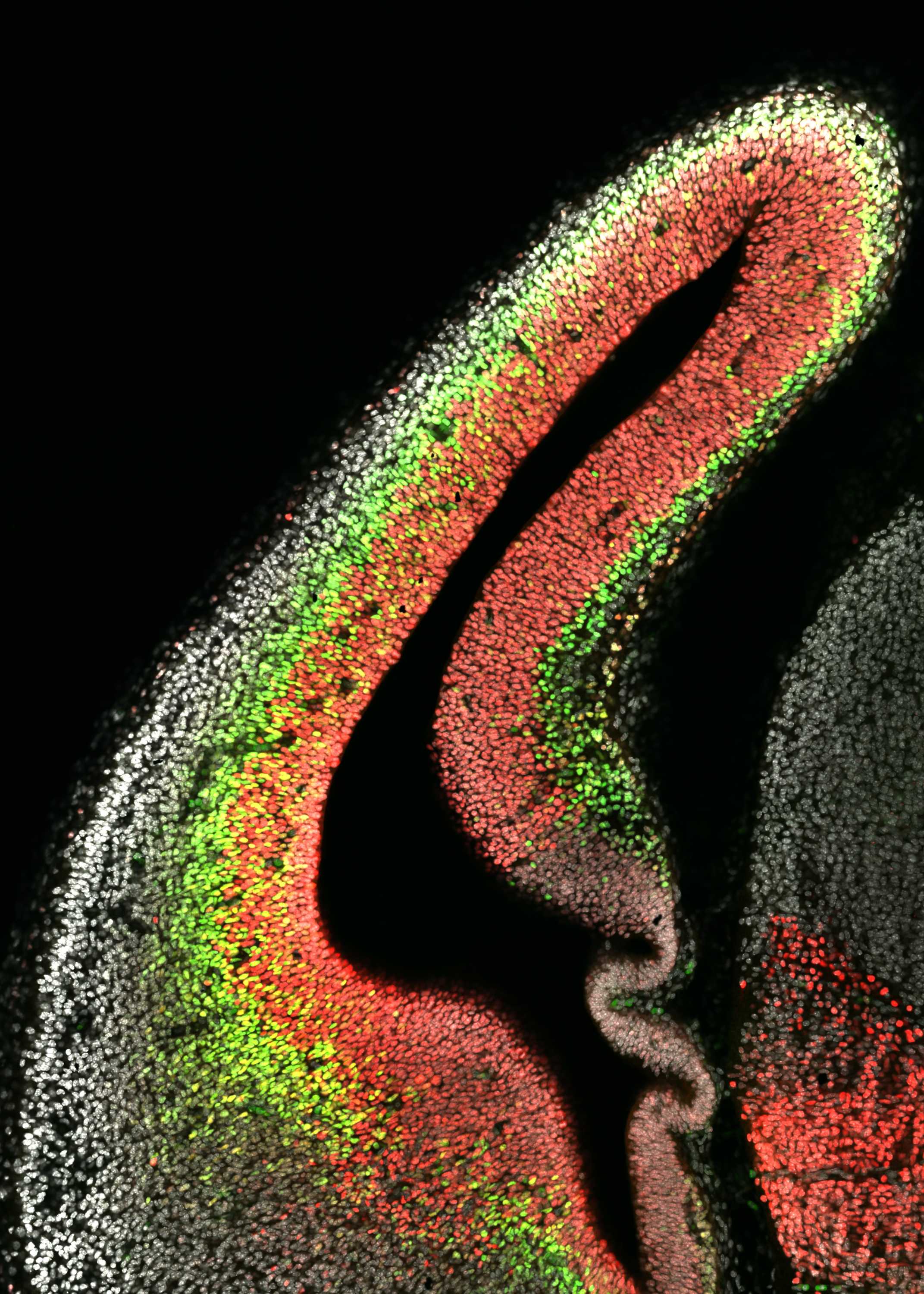 Sotos and Marshall Smith syndromes explained by gene mutation ...