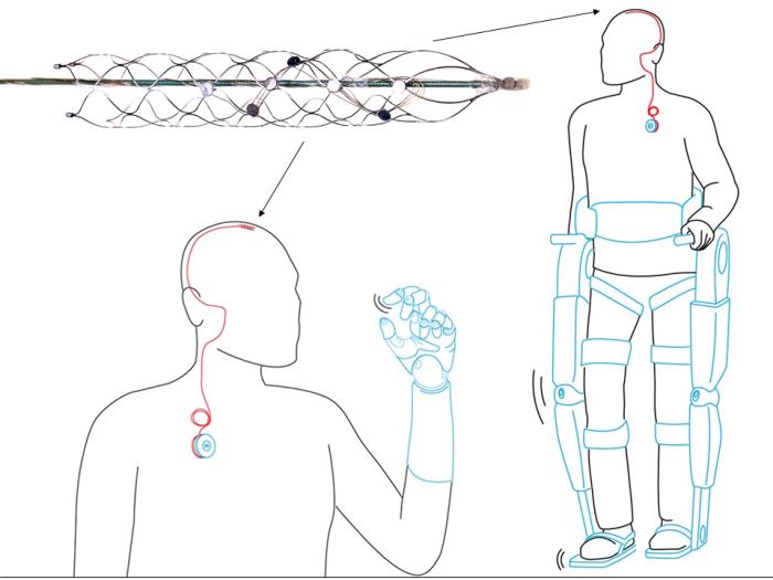 Melbourne researchers develop a paper clip-sized mind control device ...