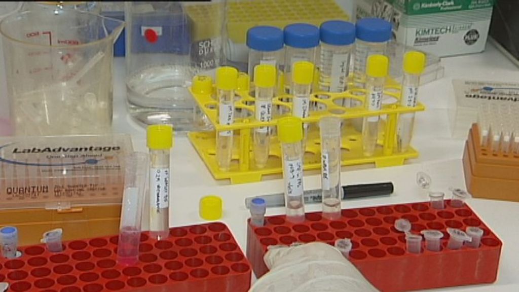 Goodnow work could make auto immune diseases better later - ABC News