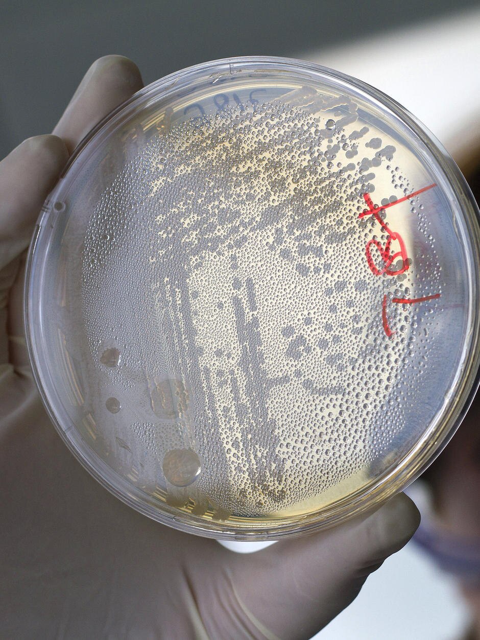 Germany struggles to find source of killer E. coli - ABC News