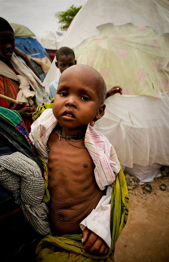 Aid groups struggling to get food to Somalia's starving - ABC listen
