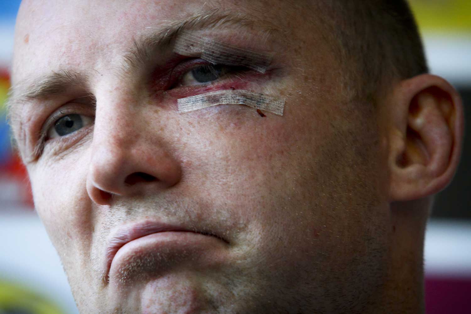 Dangerous game: the human obsession with injury - ABC News