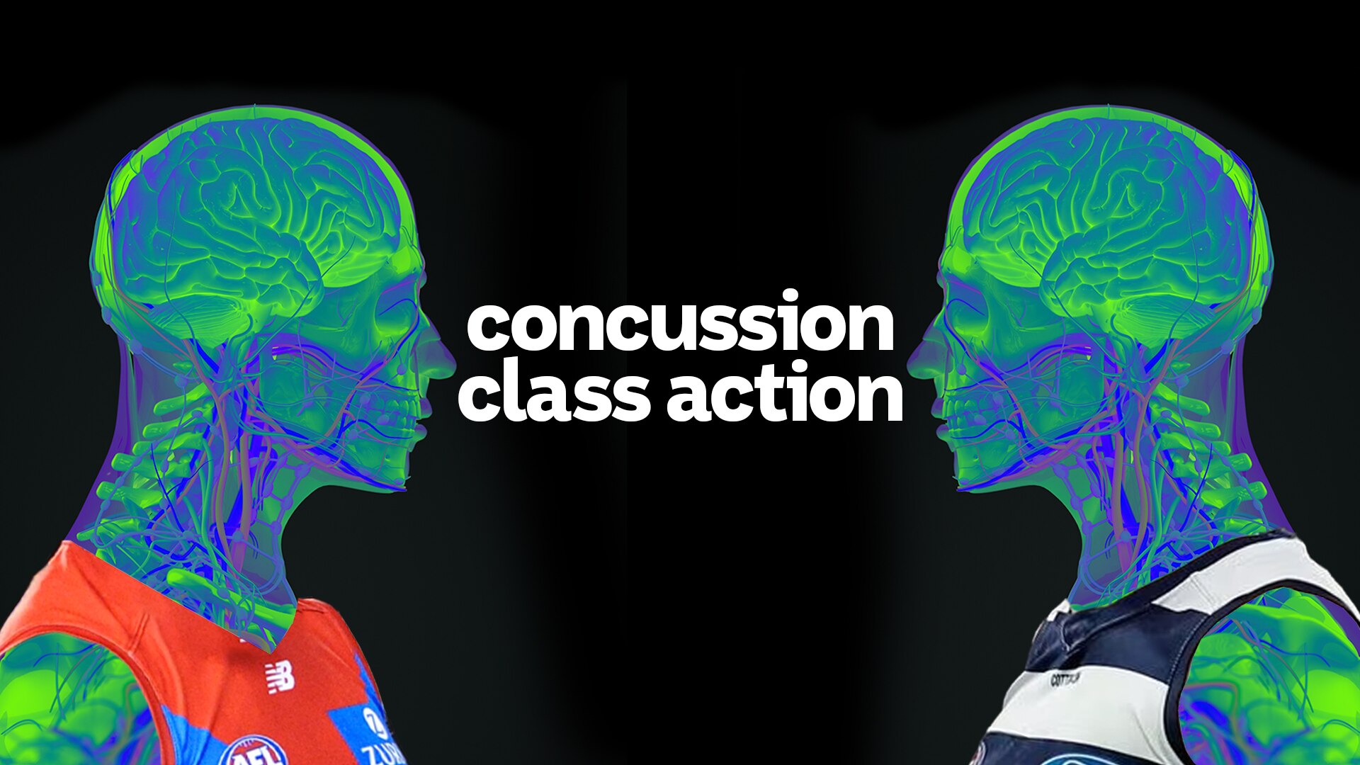 Concussion Class Action - Behind The News