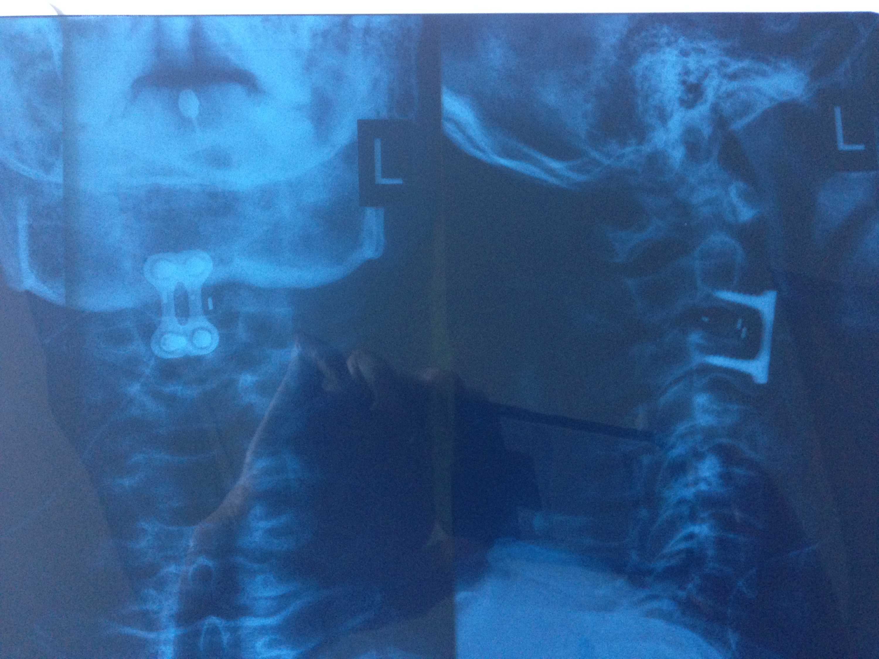 ABC Tasmania newsreader Peter Gee credits bike helmet with saving him ...