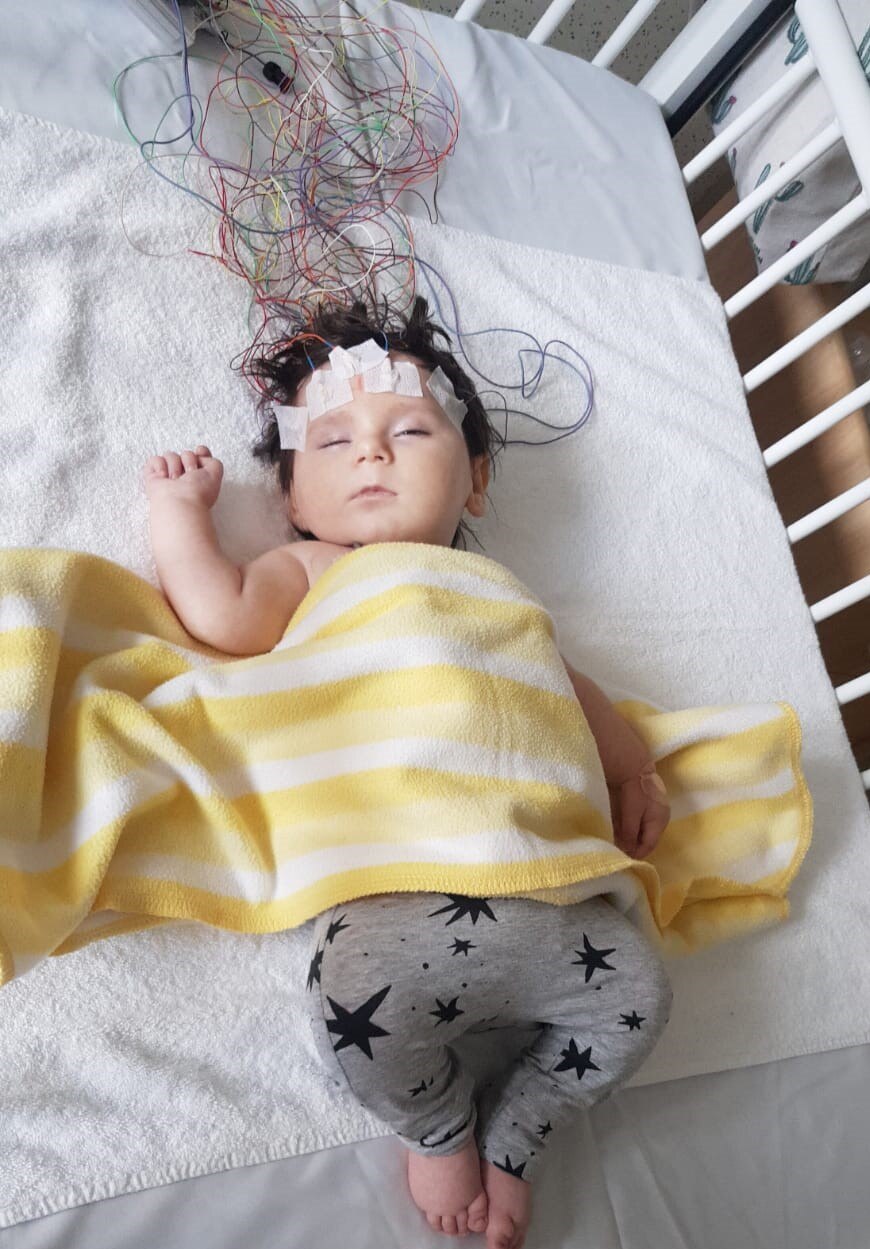 Baby Enzo Denari's brain condition is a mystery to doctors, but family ...