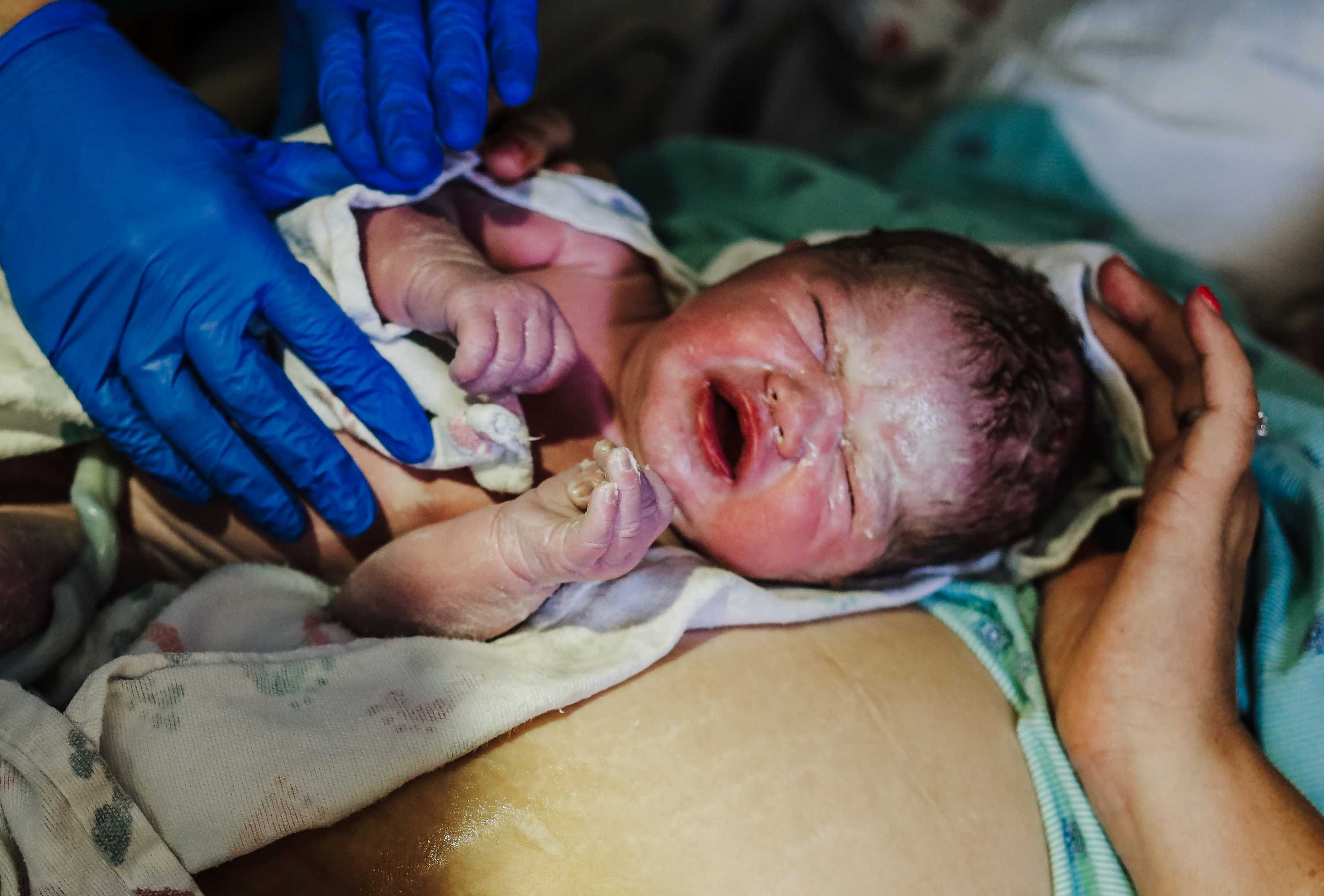 Live Birth