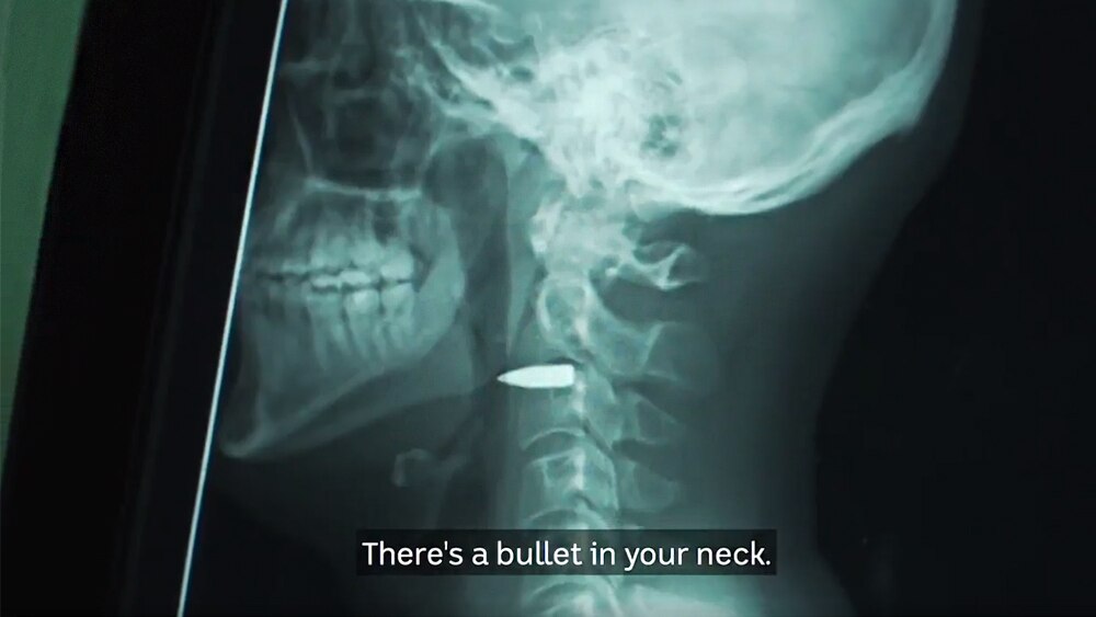 Foreign correspondent Adam Harvey on taking a bullet to the neck - triple j