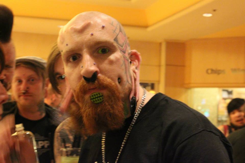 My first body mod - ABC listen