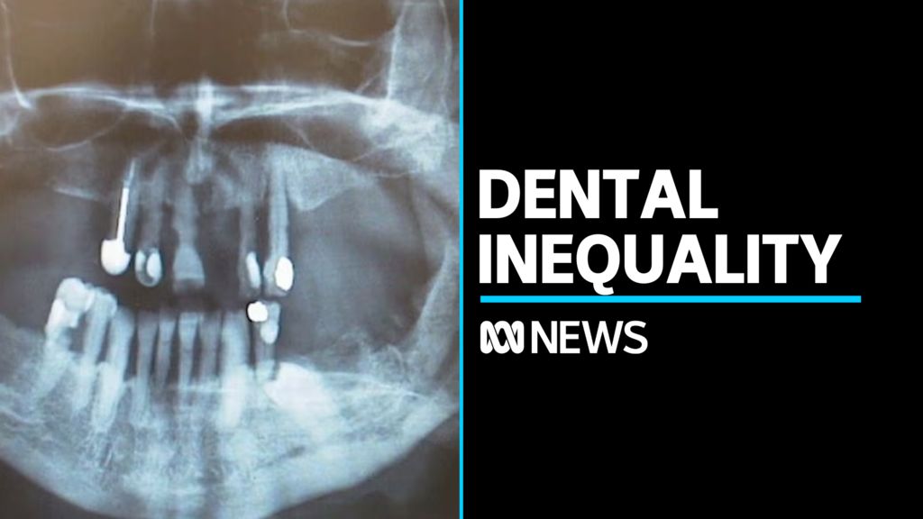 'Hidden' suffering as people with disabilities wait years for dental ...