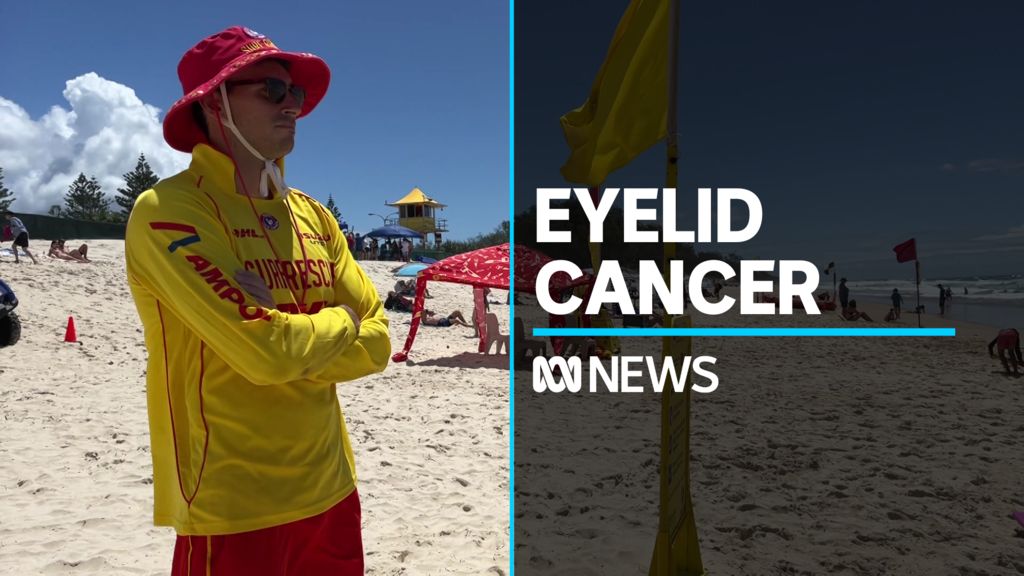 Skin Cancer - Topic - ABC News