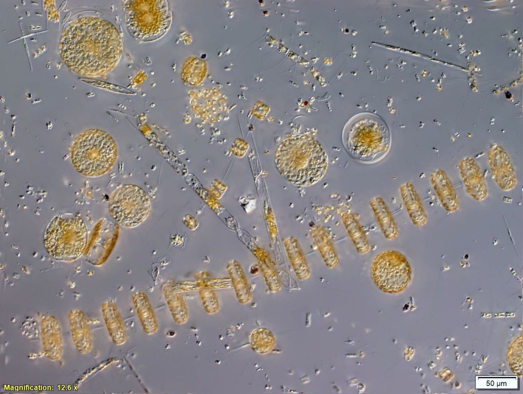Antarctic parasite found in great numbers, changing scientists' view of ...