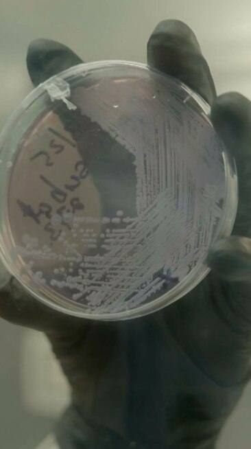 Cases of this deadly bacterial disease are on the rise — but why? - ABC ...