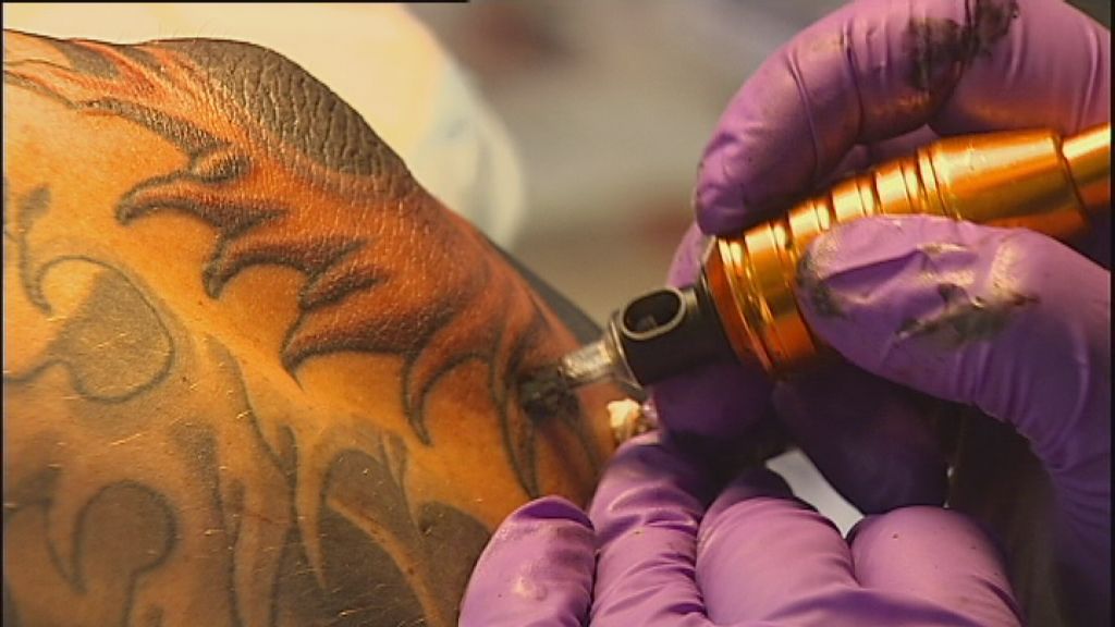 Turning the tattooed into cleanskins - ABC News