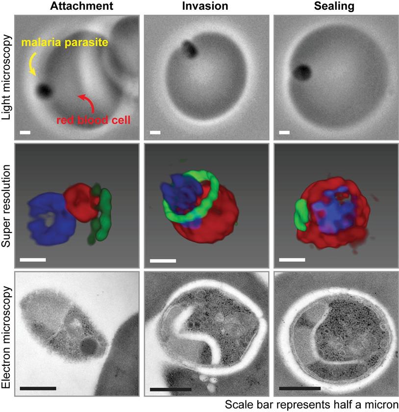 Malaria parasite filmed invading human blood cell - ABC listen