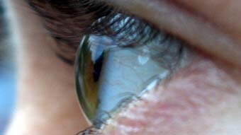 Thinking about getting laser eye surgery? Here's everything you need to ...