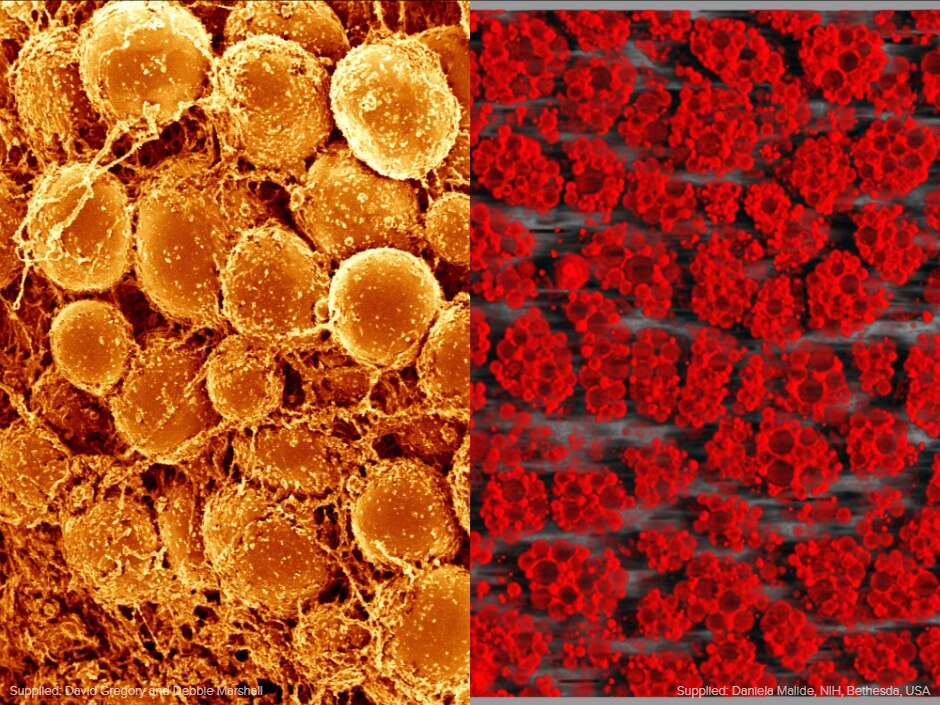 Beige and brown fat burn calories and could help manage obesity and ...