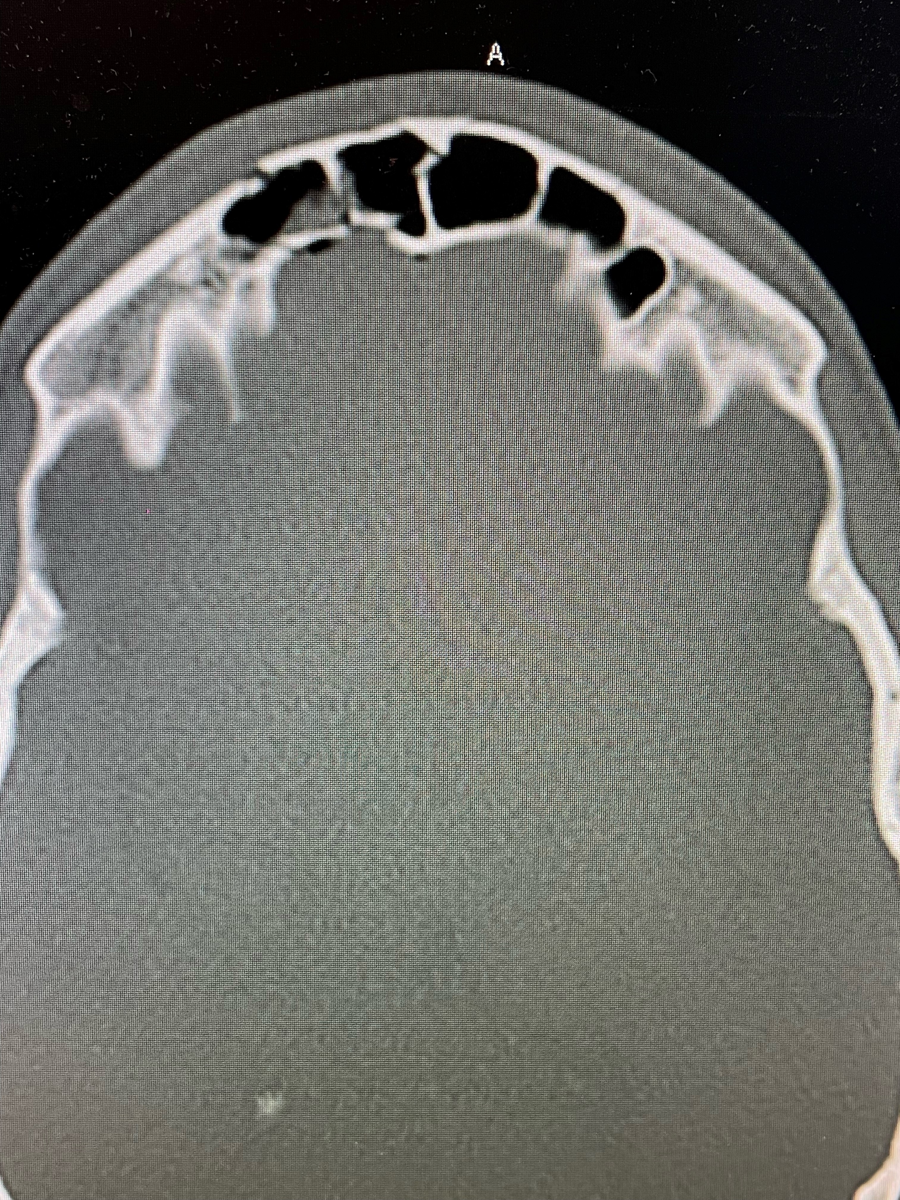 Most concussions don't happen on the sports field. Brain injury is a ...