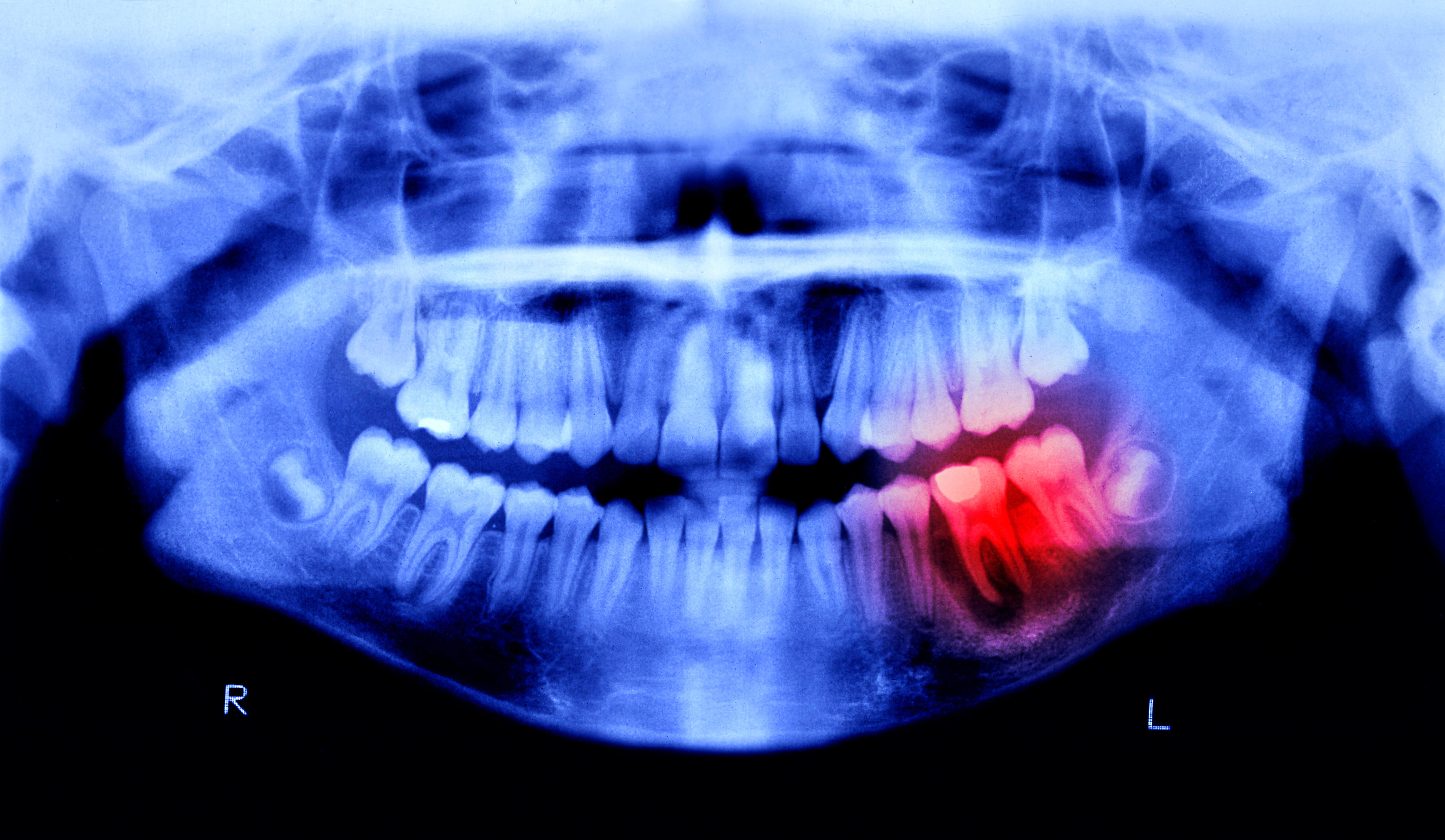 Why do humans have so many teeth troubles? - ABC listen